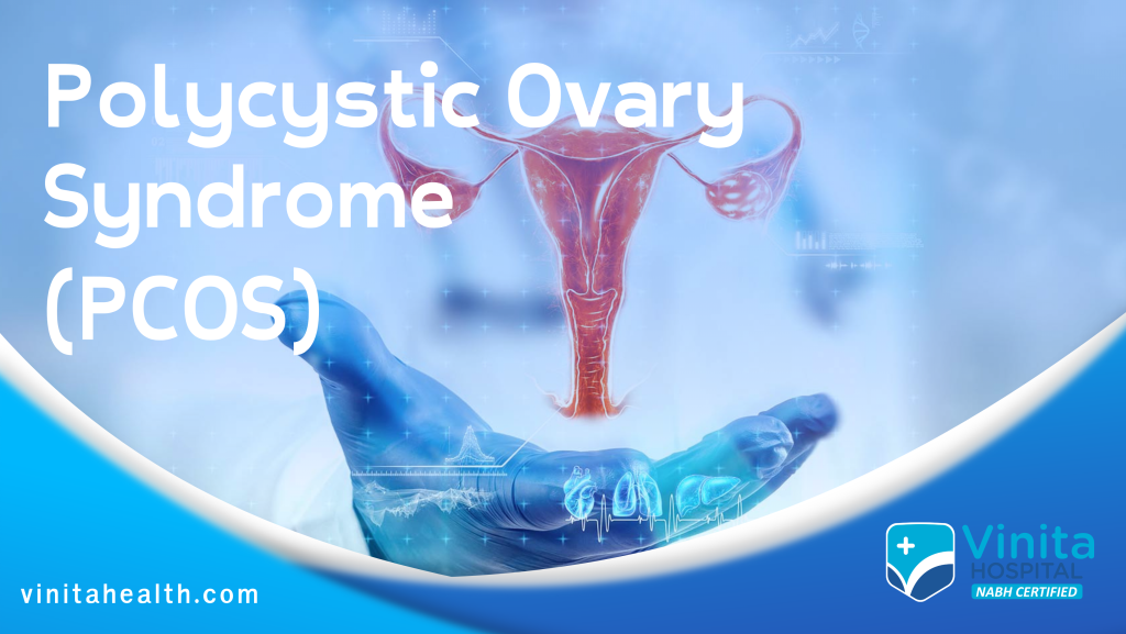 Best Hospital For Polycystic Ovary Syndrome Pcos In Chennai Vinita 5489